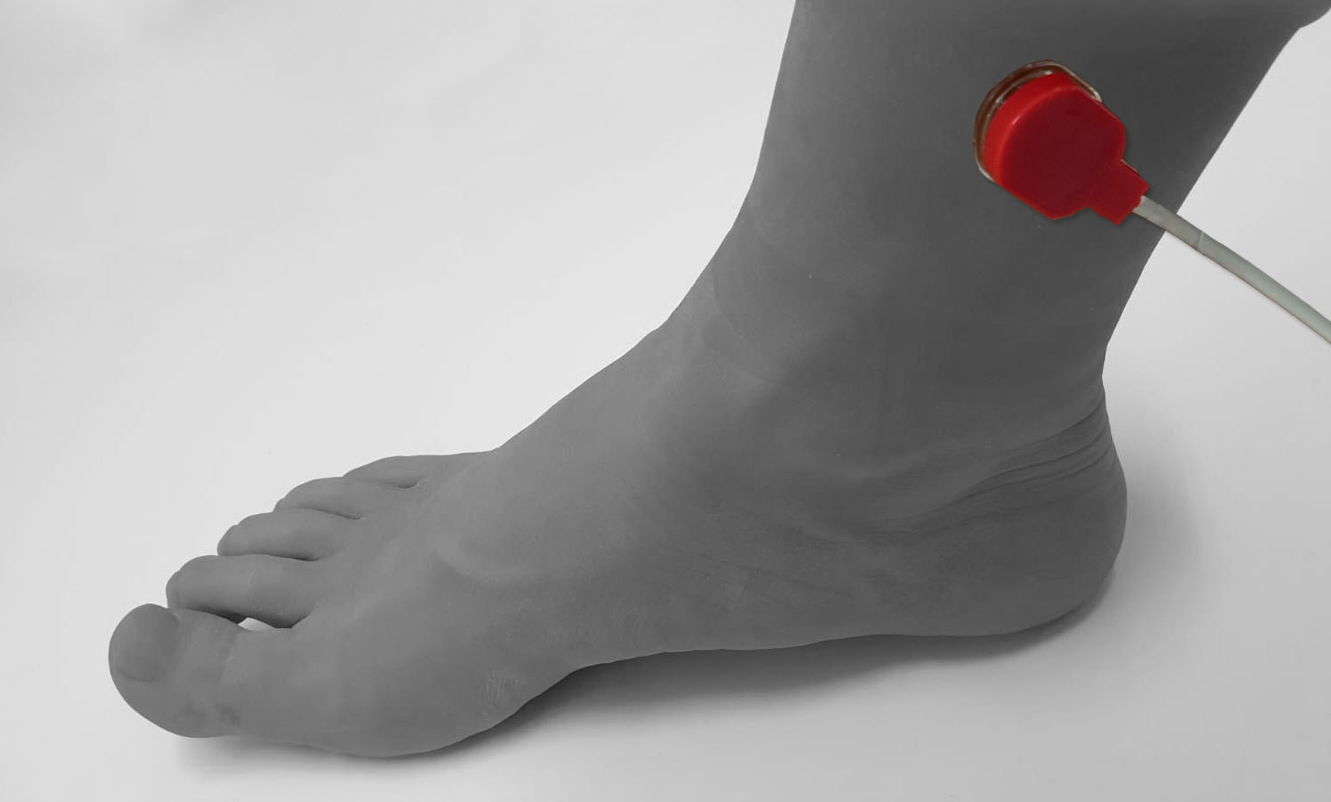 Venous Reflux Test with Peripheral Vascular Systems - Viasonix