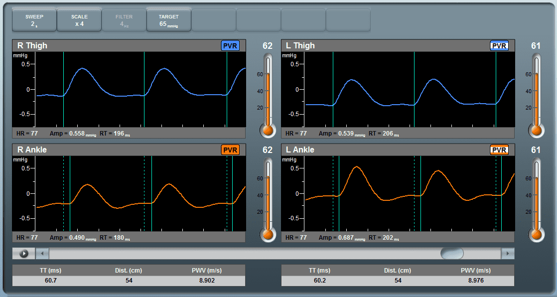 What Is Wave Velocity Measured In What Is Wave Velocity Measured In